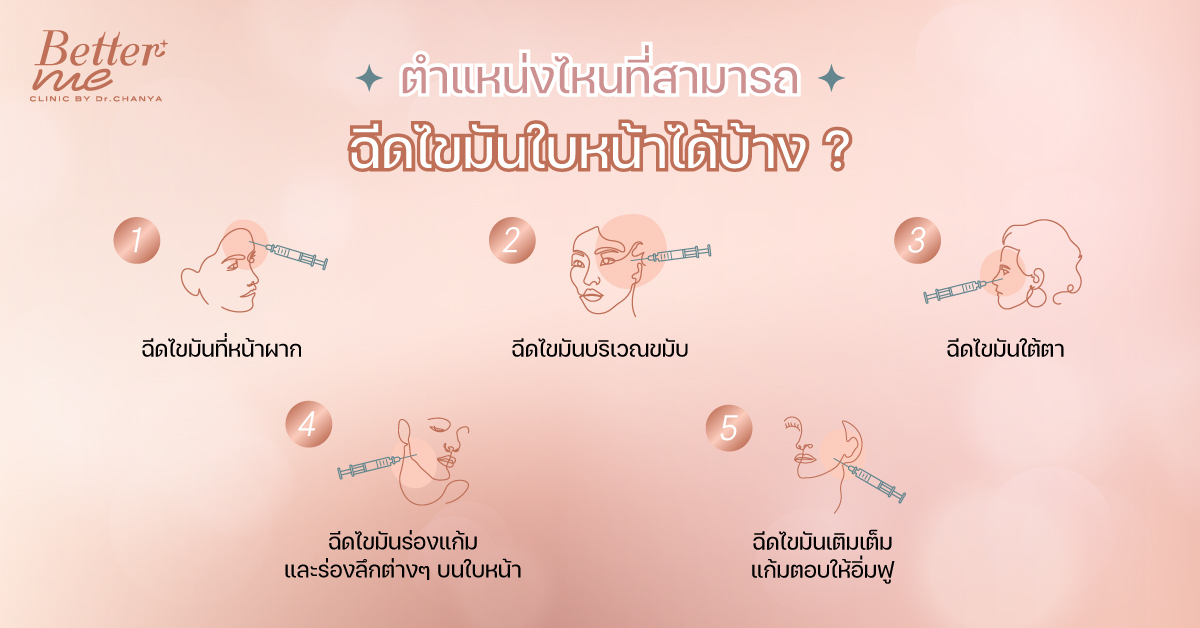 Baby Face Fat Transfer - Chanya Clinic