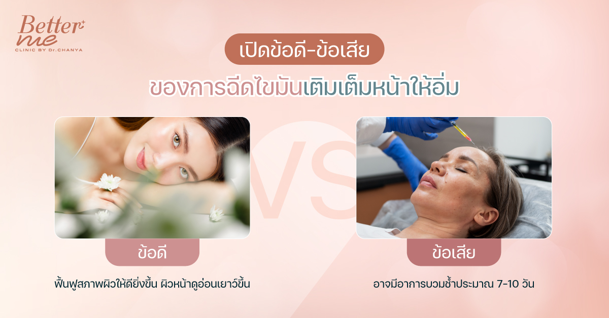 Baby Face Fat Transfer - Chanya Clinic